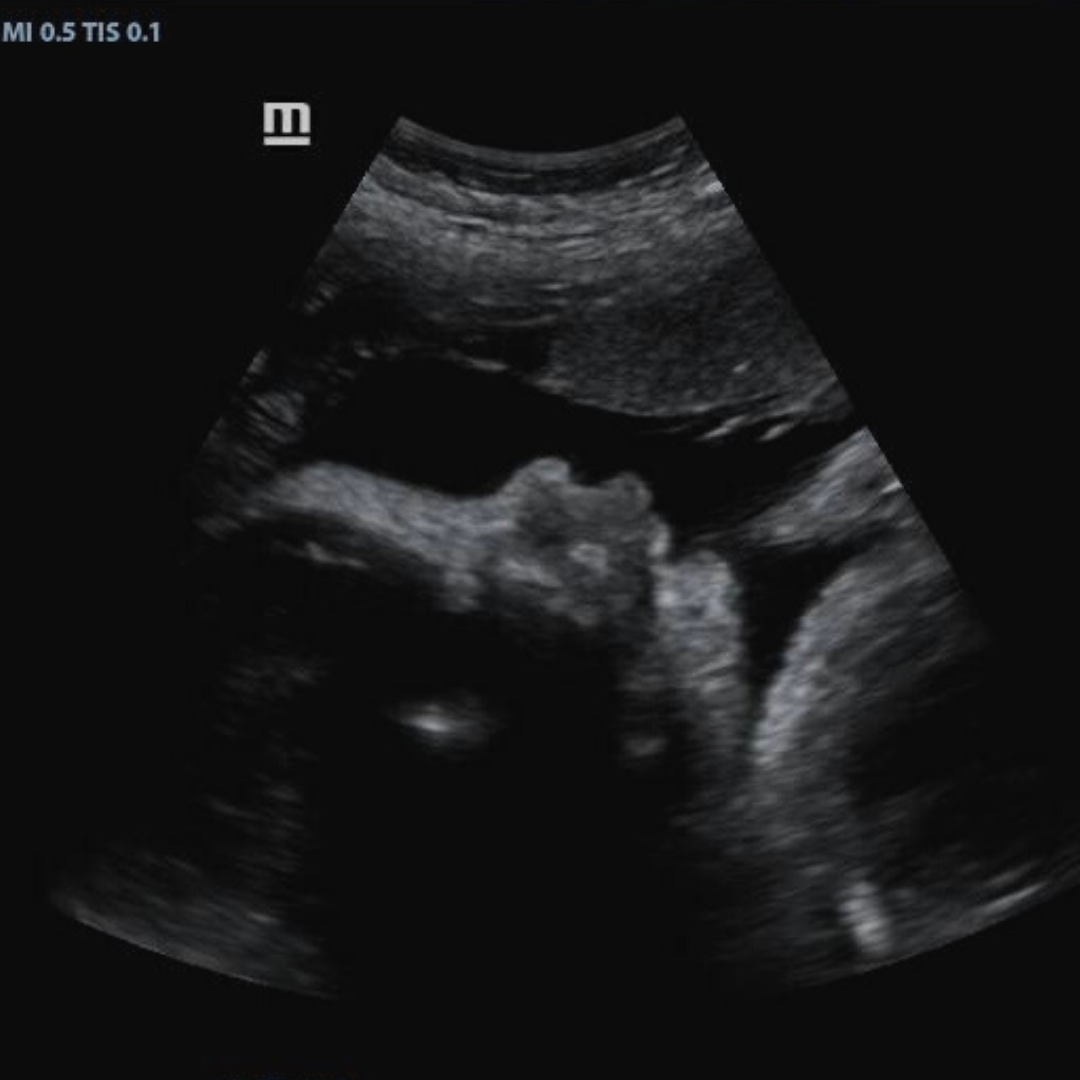 First Look Imaging – 3D/4D Ultrasounds